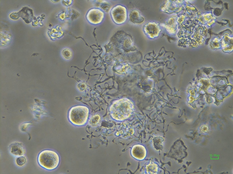CiRA・江藤教授ら、他家iPS細胞由来血小板は有効な血小板を高効率で産生するマスターセルを確立：日経バイオテクONLINE
